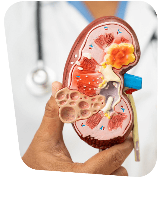 Diagnóstico de enfermedad de Addison en Ciudad de México - Dra. Ana ...